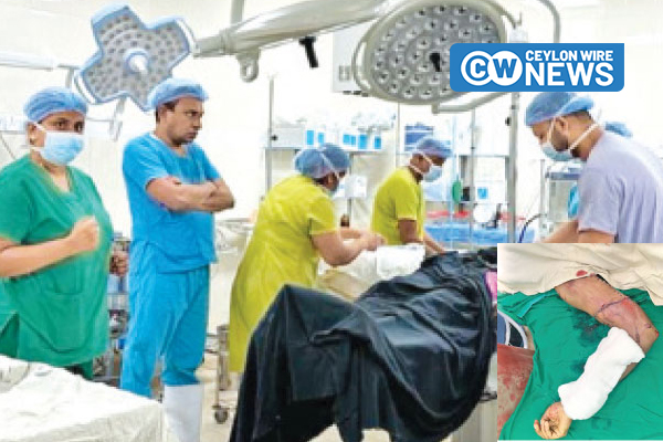 උරහිසට පහළින් සිරුරින් වෙන් වූ අත මහනුවරදී යළි බද්ධ කරයි – CEYLONWIRE