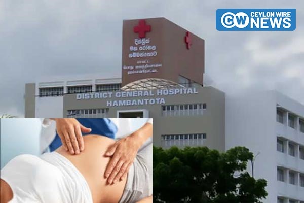 කාන්තාවකගේ ගර්භාෂයේ තිබූ කිලෝ 15ක ගෙඩියක් හම්බන්තොටදී ඉවත් කරයි – CEYLONWIRE